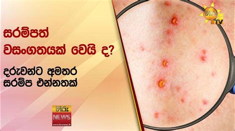 සරම්පත් වසංගතයක් වෙයි ද දරුවන්ට අමතර සරම්ප එන්නතක් Hiru News Youtube