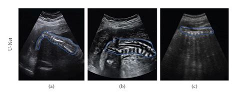 The Segmentation Effects Of U Net Download Scientific Diagram