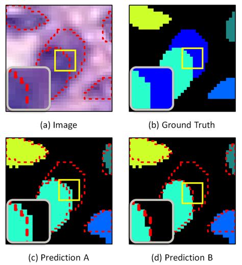 2019 Mia Hover Net Simultaneous Segmentation And Classification Of Nuclei In Multi Tissue