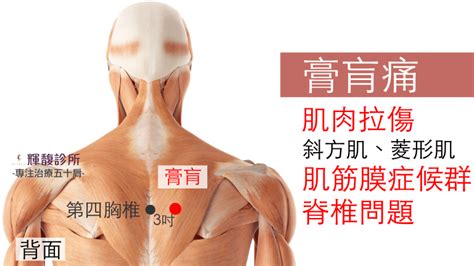 「醫生，背上的這個點好痛！」 輝馥診所