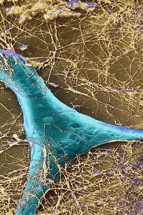 Fibroblast And Collagen Sem Stock Image C030 9219 Science Photo Library