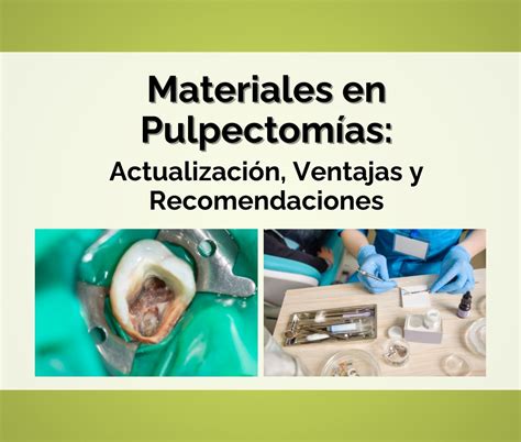 Materiales En Pulpectomías Actualización Ventajas Y Recomendaciones