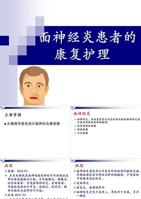 面神经炎的康复PPT 卡卡办公