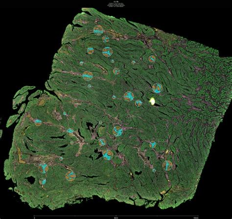 The Geomx® Wta Atlas For The Digital Spatial Profiler