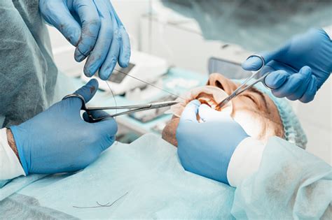 치과 의사는 수술 임플란트 배치를 수행합니다 실제 작동 치아 추출 임플란트 전문 유니폼과 치과 의사의 장비 의료 는 의사 작업장 장착 치과 3 명에 대한 스톡 사진 및 기타