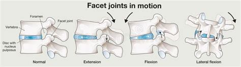 The Mobility Of The Lumbar Vertebrae Facet Joint Medical Illustration