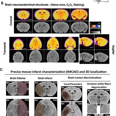 Identification Of Brain Neuroanatomical Areas In Download