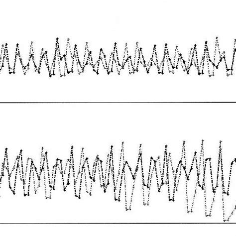 Dynamics Of Population In The Model With The Reflexive Behavior Of Download Scientific Diagram