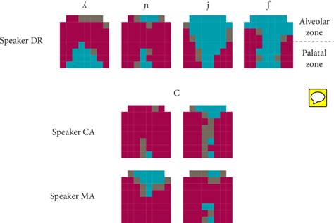 Electropalatographic Linguopalatal Contact Configurations Gathered At
