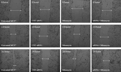 Migration Assay Comparing The Speed In Gap Closure In A Monolayer Of Download Scientific