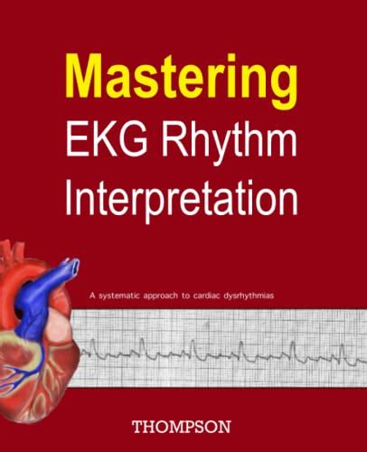 Mastering Ekg Rhythm Interpretation A Systematic Approach To Cardiac Dysrhythmias By Thompson