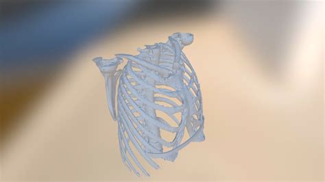 Pectus Excavatum Whole Model 20160215 3d Model By Fablabndmc [119d831] Sketchfab