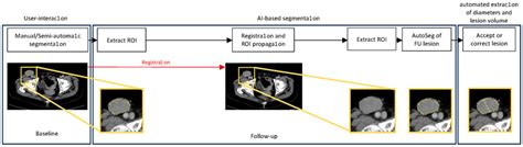 Schema Of The Proposed Pipeline For The Ai Assisted Segmentation Of Download Scientific Diagram