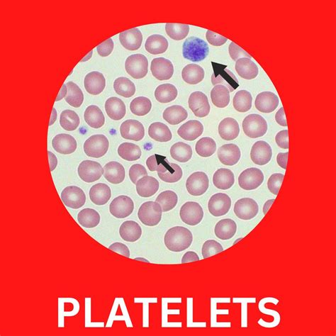Platelet Estimate Counter The Mislabeled Specimen