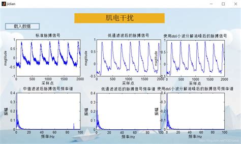 【肌电信号】基于matlab gui脉搏信号分析 去噪 特征提取 【含matlab源码 862期】 云社区 华为云