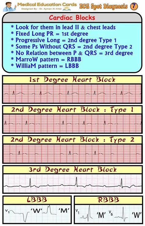 Cardiac Rhythms Cheat Sheet