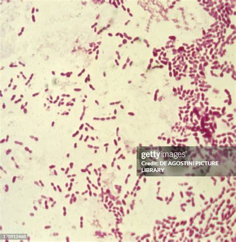 Diplococcus Photos And Premium High Res Pictures Getty Images