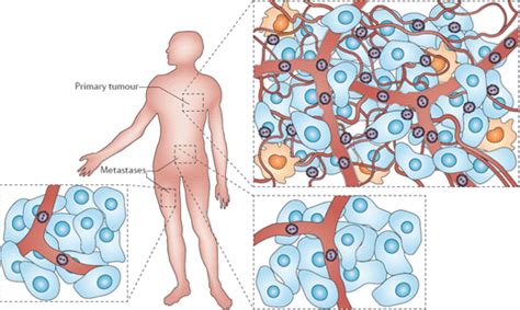 Illustration Of The Epr Effect The Epr Effect Allows Nanoparticles To Download Scientific