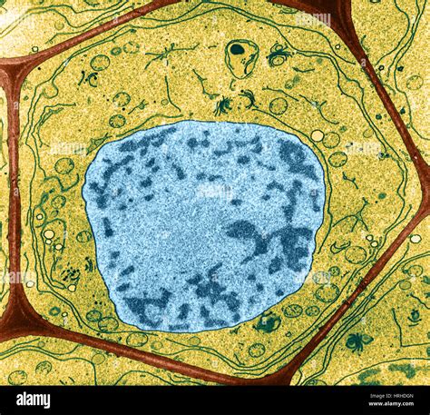 Plant Cells Electron Microscope Cell Structures Under An Electron