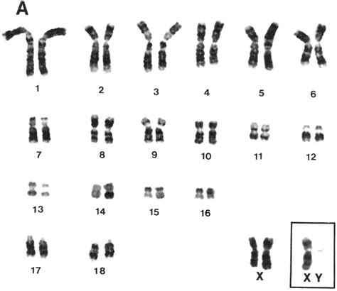A Female G Banded Karyotype Of P C Capensis 2n 38 The Inset