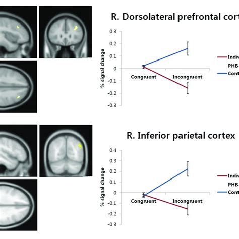 Brain Activation Patterns In The Right Dorsolateral Prefrontal Cortex Download Scientific