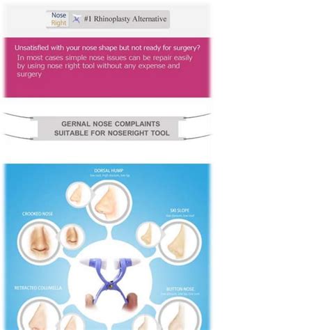 Without Surgery Reshape Your Nose Pdf