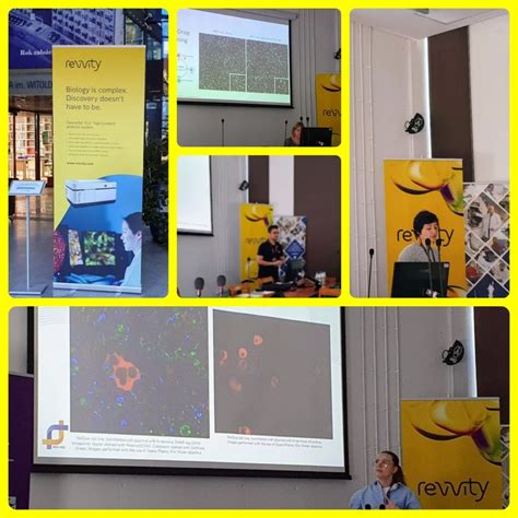 Imran Hassan On Linkedin Hcs Highcontentimaging Unitedinscience Unitedininnovation