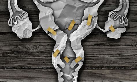 Reconstructive Plastic Surgery