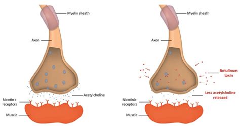 Clostridium Botulinum Bacteria