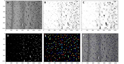 A Pipeline For The Astrocyte Quantification Raw Image From The