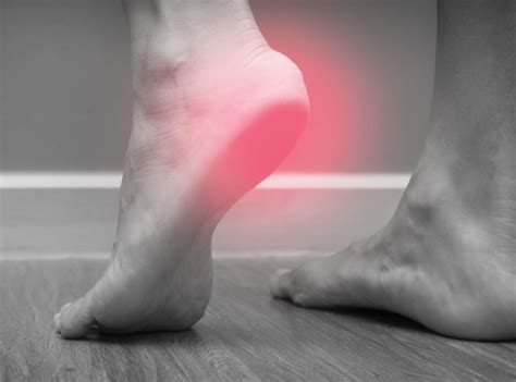 What Is Arthrodesis Toe How To Treat And Recover Foot And Ankle