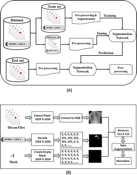 The Proposed Methodology Of Pneumothorax Segmentation A Overview Of