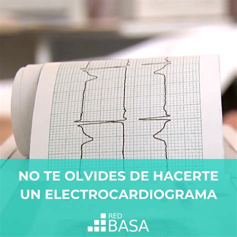 👉con El Electrocardiograma Se Puede Conocer El Estado De Salud Del