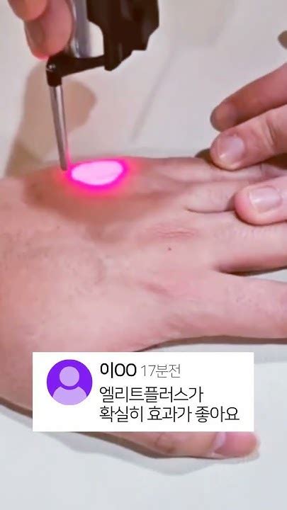 레이저제모 아포지플러스 Vs 아포지엘리트플러스 달라요 Youtube