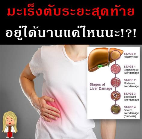 ยารักษาใจ มะเร็งตับระยะสุดท้าย อยู่ได้นานแค่ไหนนะ จากข่าวดาราหรือใครมากมากมายๆ ต่างประสบ