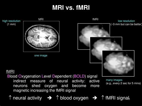 ppt 1 introduction to fmri powerpoint presentation free download
