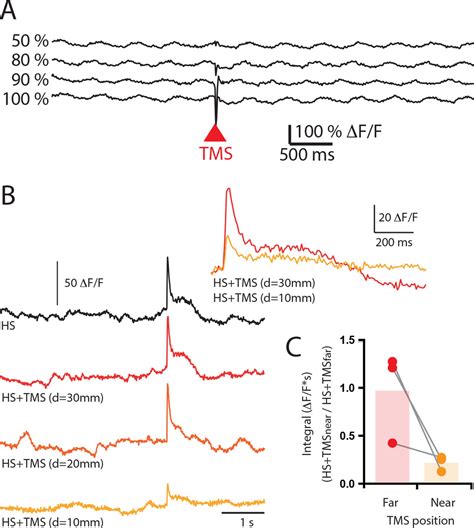 Figures And Data In Transcranial Magnetic Stimulation Tms Inhibits