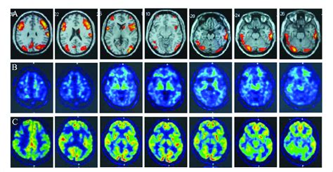 Multimodality Molecular Imaging Of The Patient A Multimodal