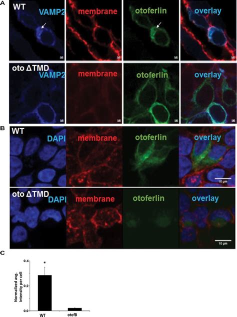 Loss Of The Tmd Reduces Expression Of Otoferlin In Cell Culture A