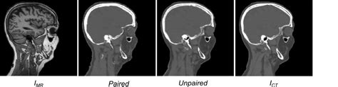 From Left To Right Input Mr Image Synthesized Ct Image With Paired