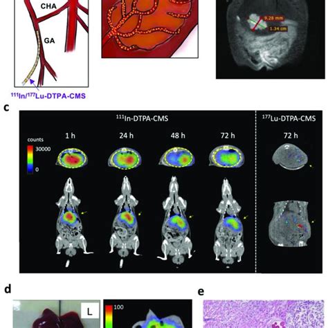 Preparation Of Radiolabeled Chitosan Microspheres A The Schematic