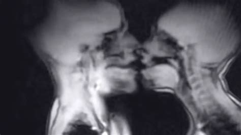 Couple Had Sex In Mri Machine To See What Actually Happens To Your Body