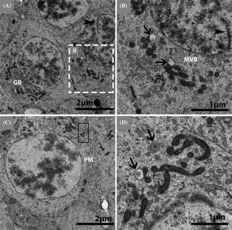 Transmission Electron Micrograph Of Primary Spermatocytes At The Download Scientific Diagram