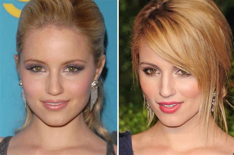 Celebrity Nose Jobs Before And After Irish Mirror Online
