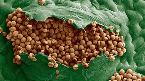 Bean Rust Spores Stock Video Clip K008 4937 Science Photo Library