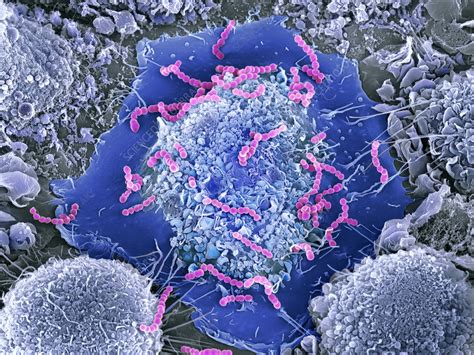 Macrophages Infected With Streptococcus Pyogenes Sem Stock Image C057 8605 Science Photo