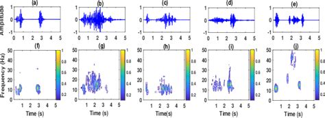 Figure 2 From Classification Of Pcg Signals Using Fourier Based Synchrosqueezing Transform And