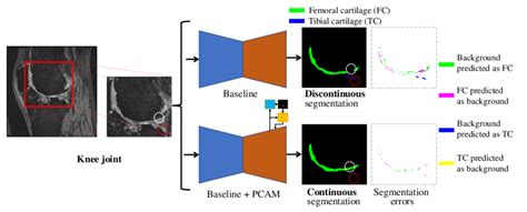 The Knee Cartilage Segmentation Results From The Primary Baseline 7