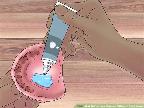 7 Tips To Remove Denture Adhesive From Gums Wikihow
