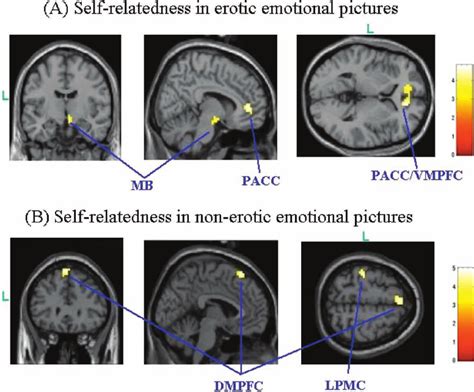 Parametric Correlation Maps Of Self Relatedness For Erotic And Download Scientific Diagram